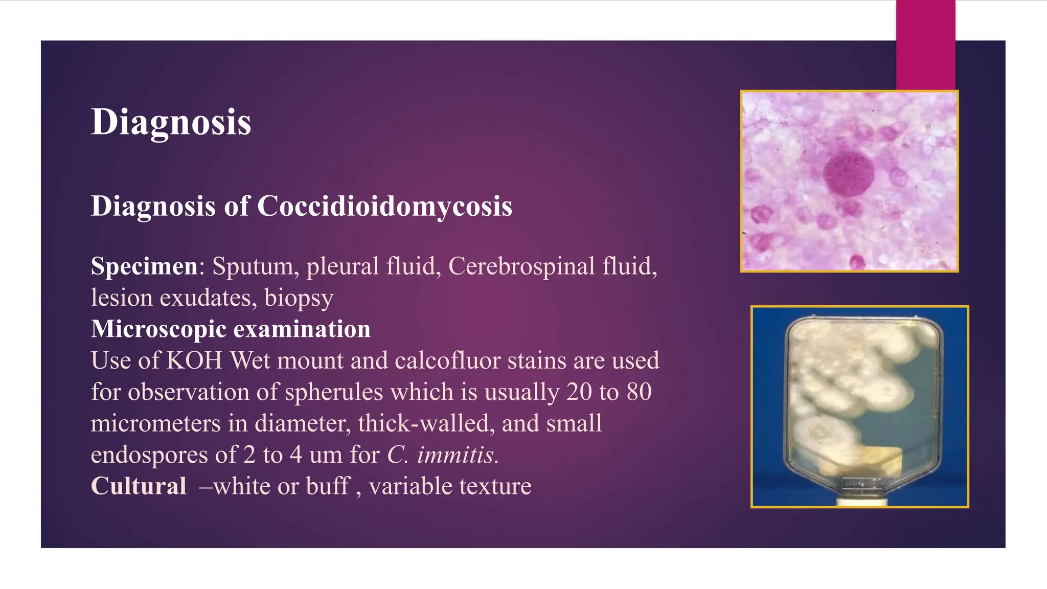 Understanding Coccidioidomycosis: Causes, Symptoms, and Treatment. | PPTX