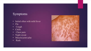 Understanding Coccidioidomycosis: Causes, Symptoms, and Treatment. | PPTX