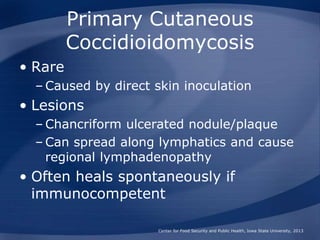 Coccidioidomycosis (1).ppt for education | PPT