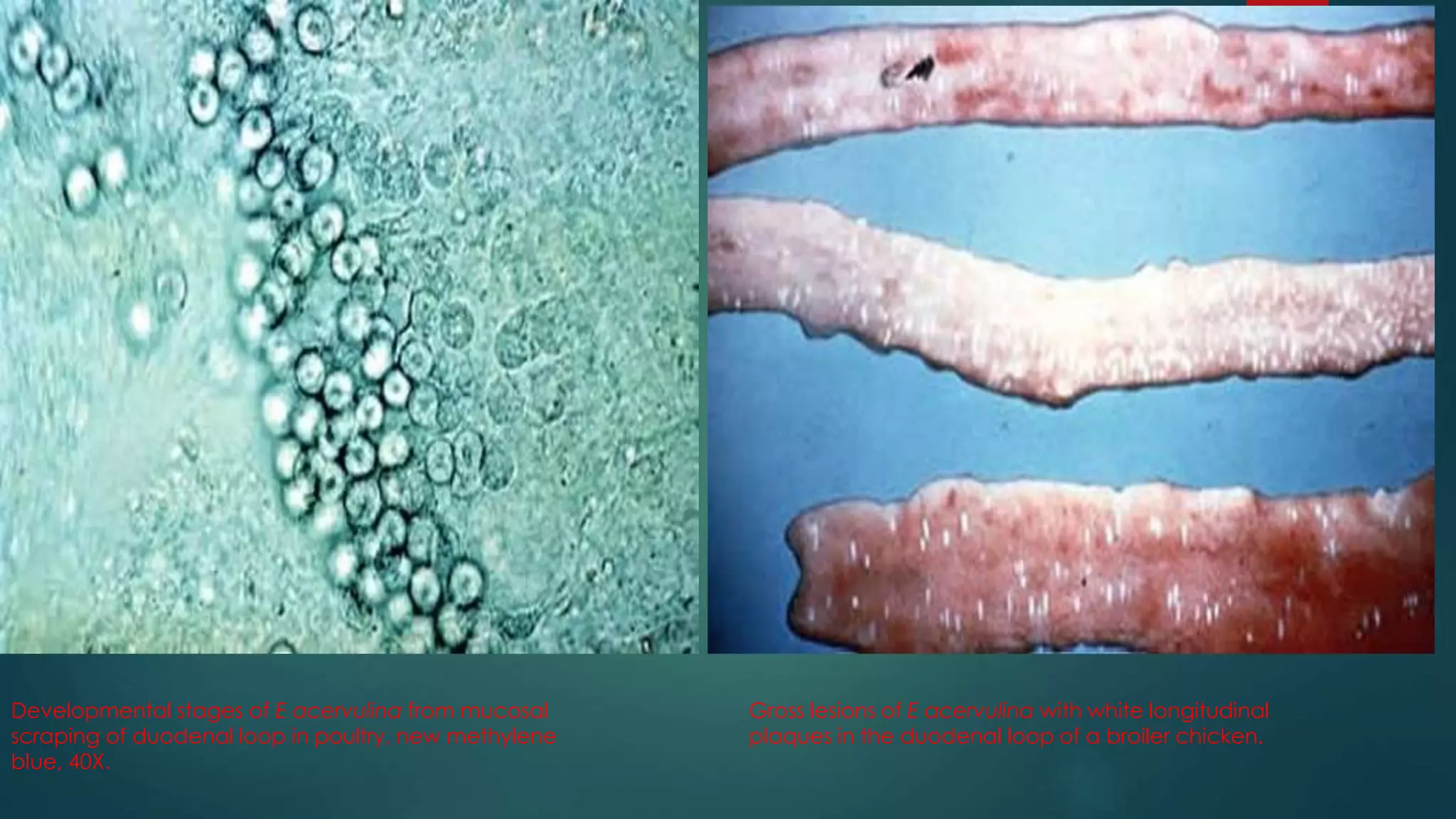 Coccidiosis in poultry | PPTX