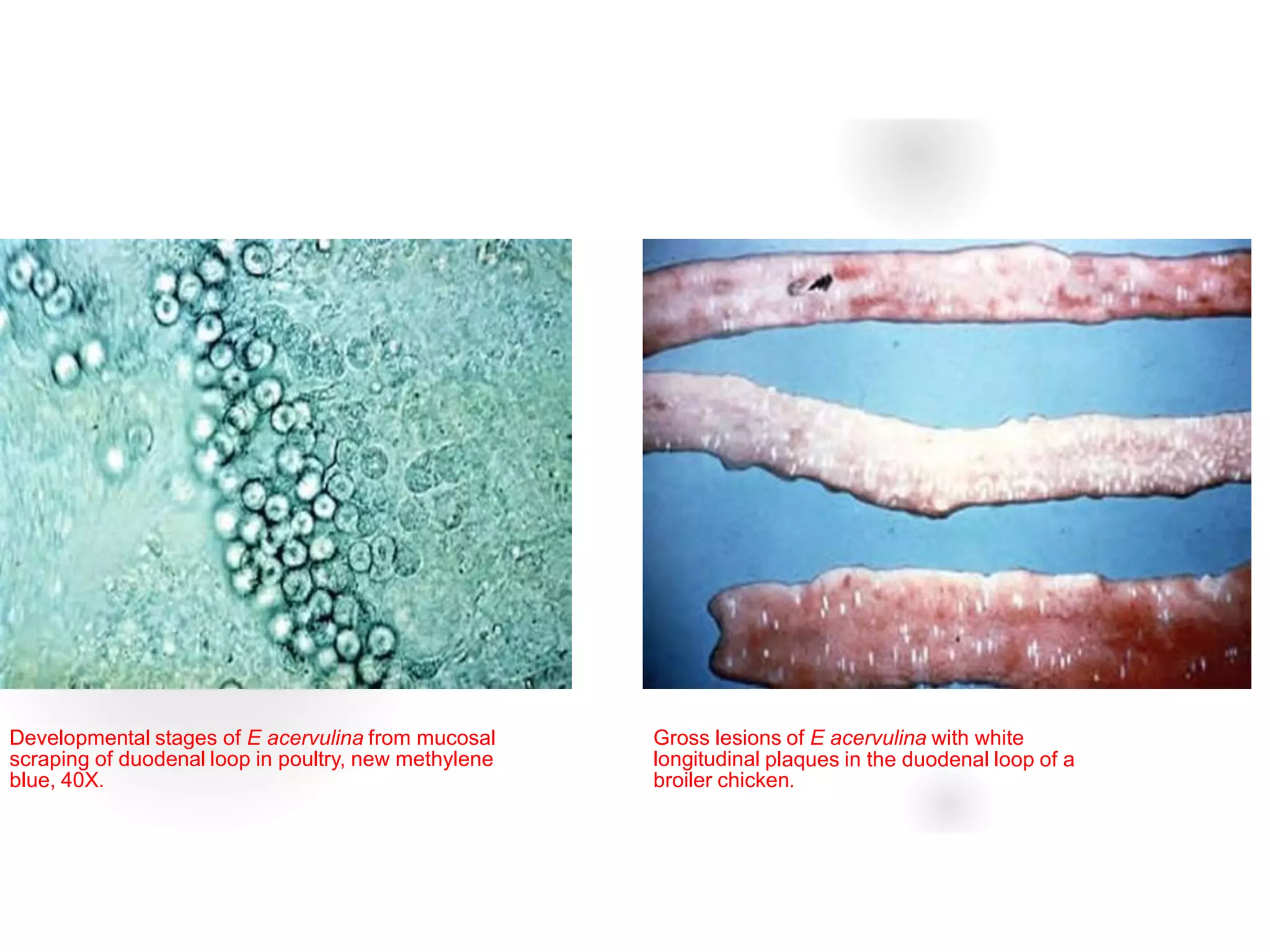 Coccidiosis | PPTX