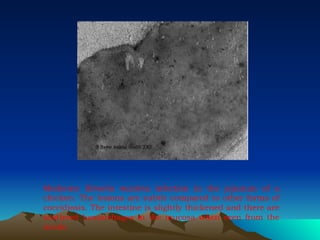 -Coccidiosis in poultry birds , etiology clinical signs and diagnosis | PPT