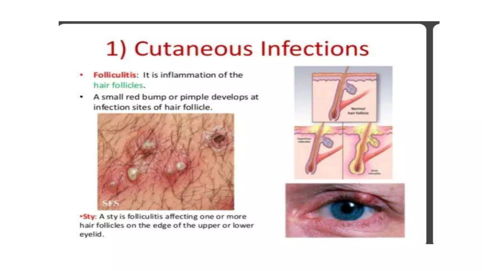 Cocci , staphylococcus microbiology | PPTX