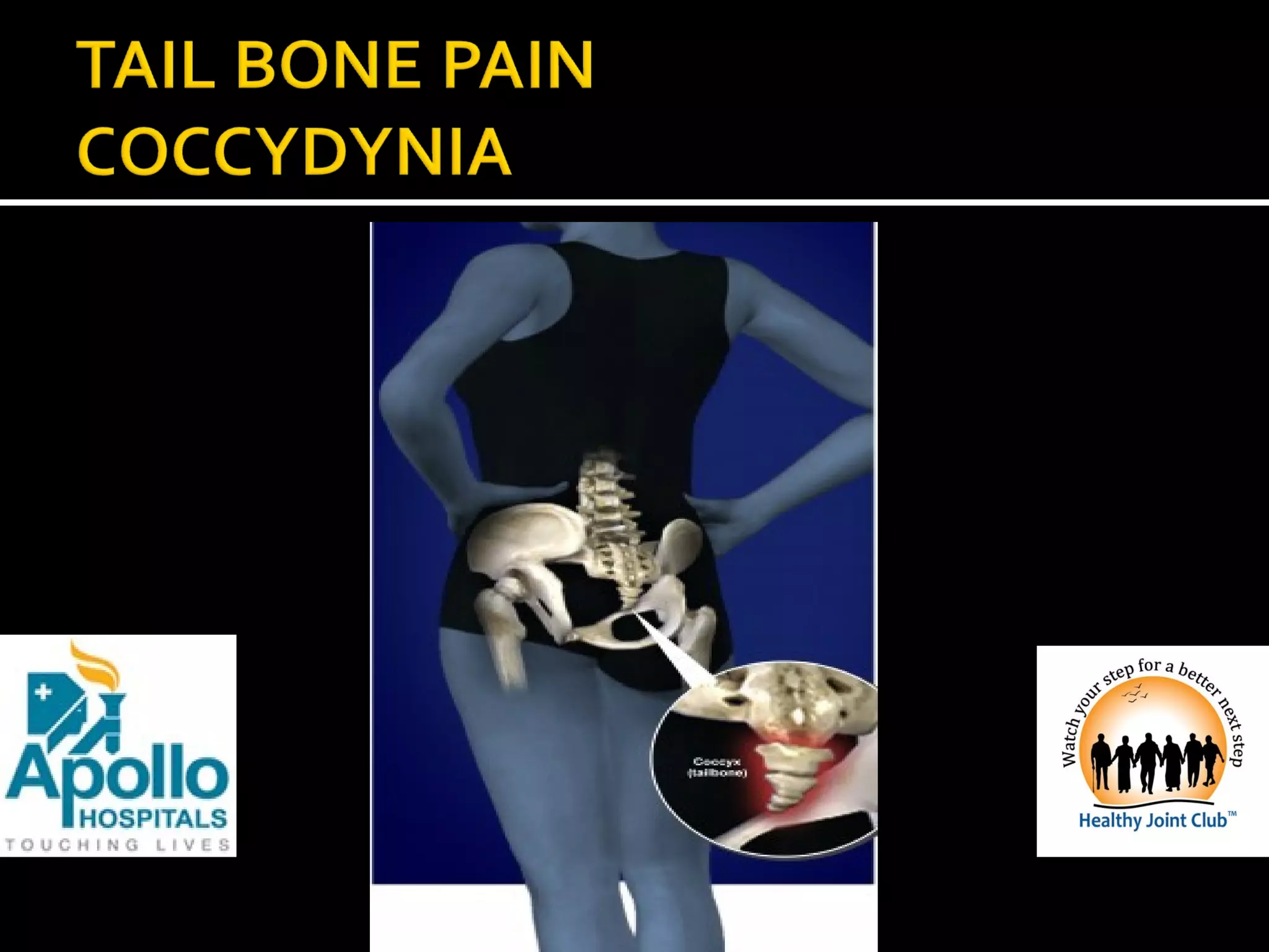 Tail bone pain / Coccydynia | PPT