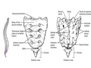Coccydynia | PPTX