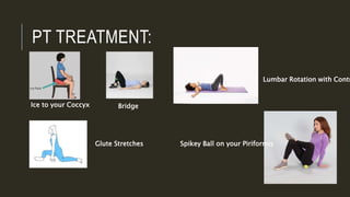 coccydynia.pptx
