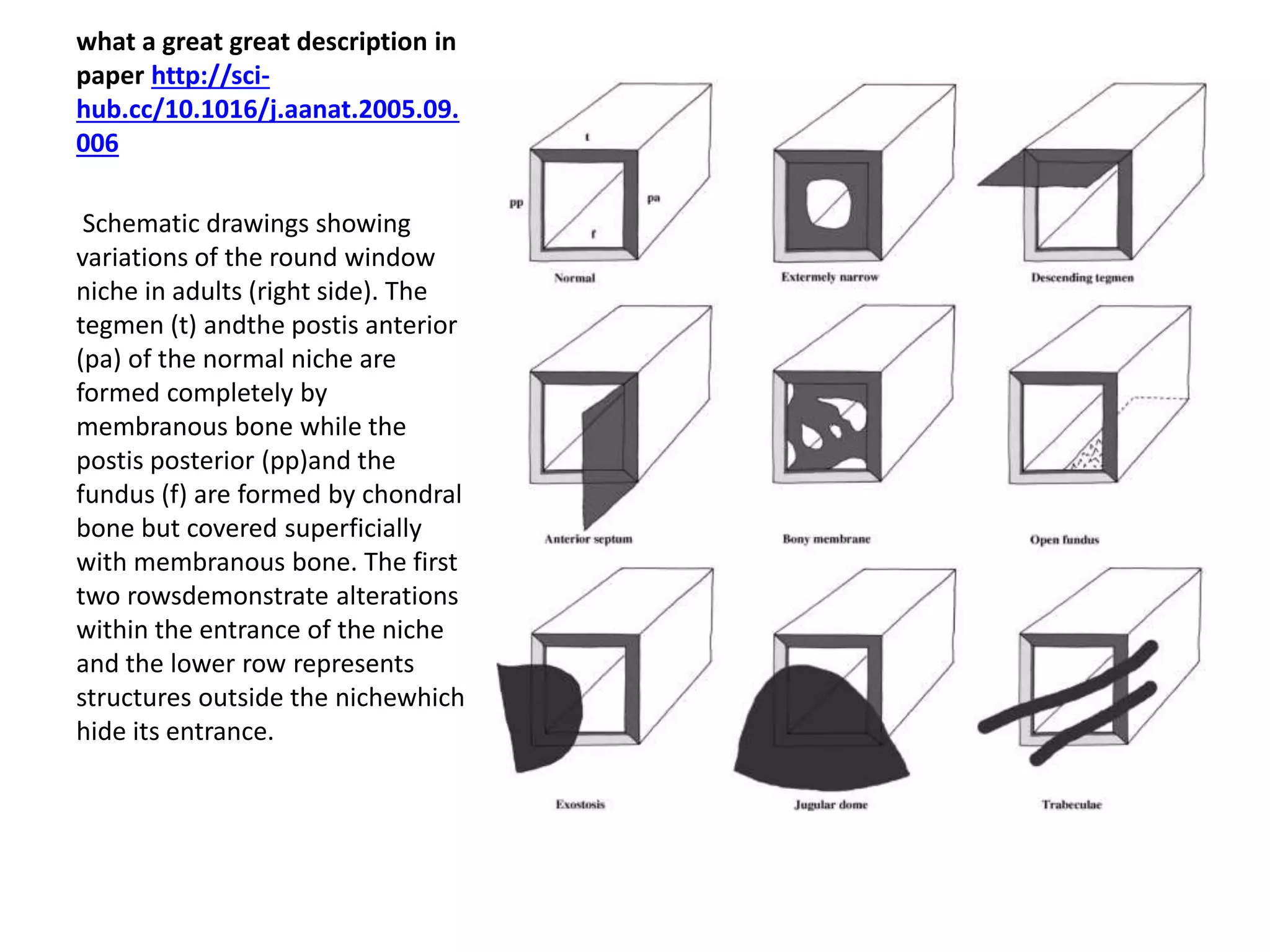 Cochlea cadaver dissection - part 1 | PPTX