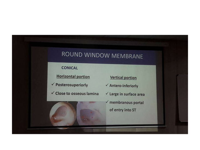 Cochlea cadaver dissection - part 1 | PPT