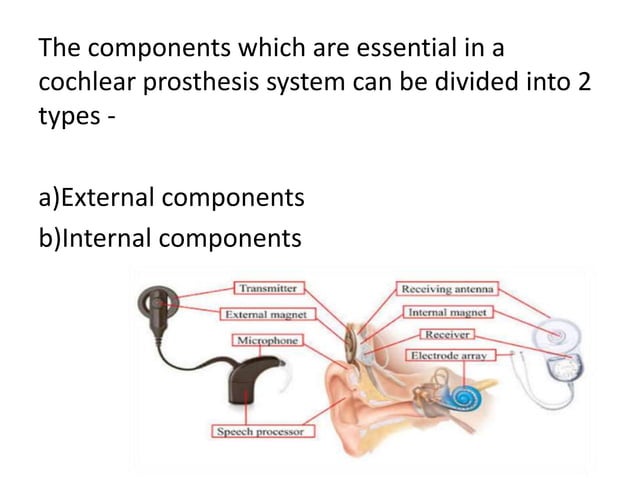 cochlear corporation.pptx