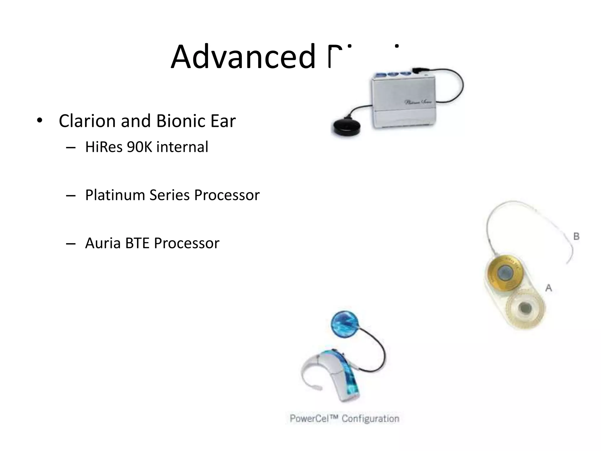 Cochlear implantation | PPTX