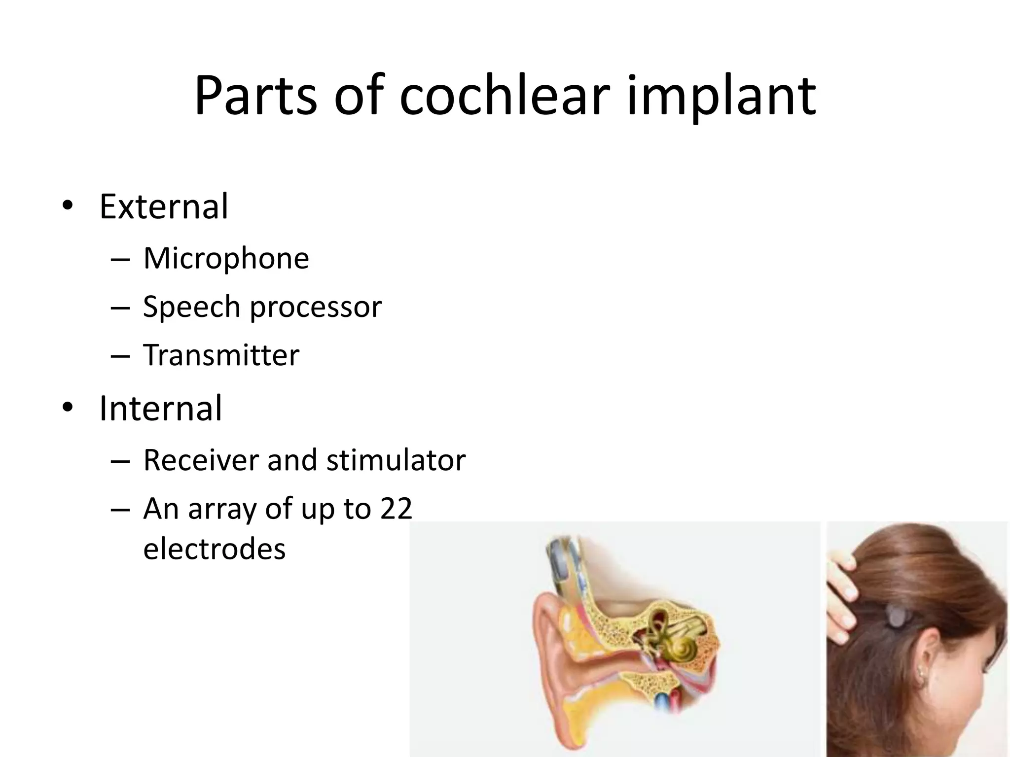 COCHLEAR IMPLANTATION over view | PPTX
