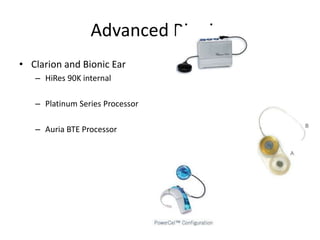 COCHLEAR IMPLANTATION over view | PPTX