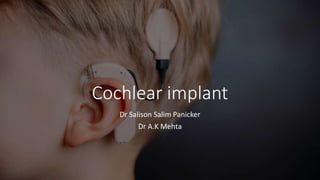 Cochlear Implant complete presentation by Dr Salison Salim Panicker | PPT