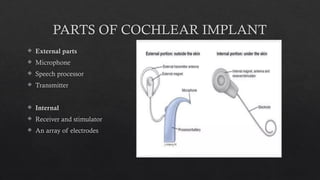 COCHLEAR IMPLANT - BASIC GUIDE FOR JUNIOR RESIDENTS | PPTX