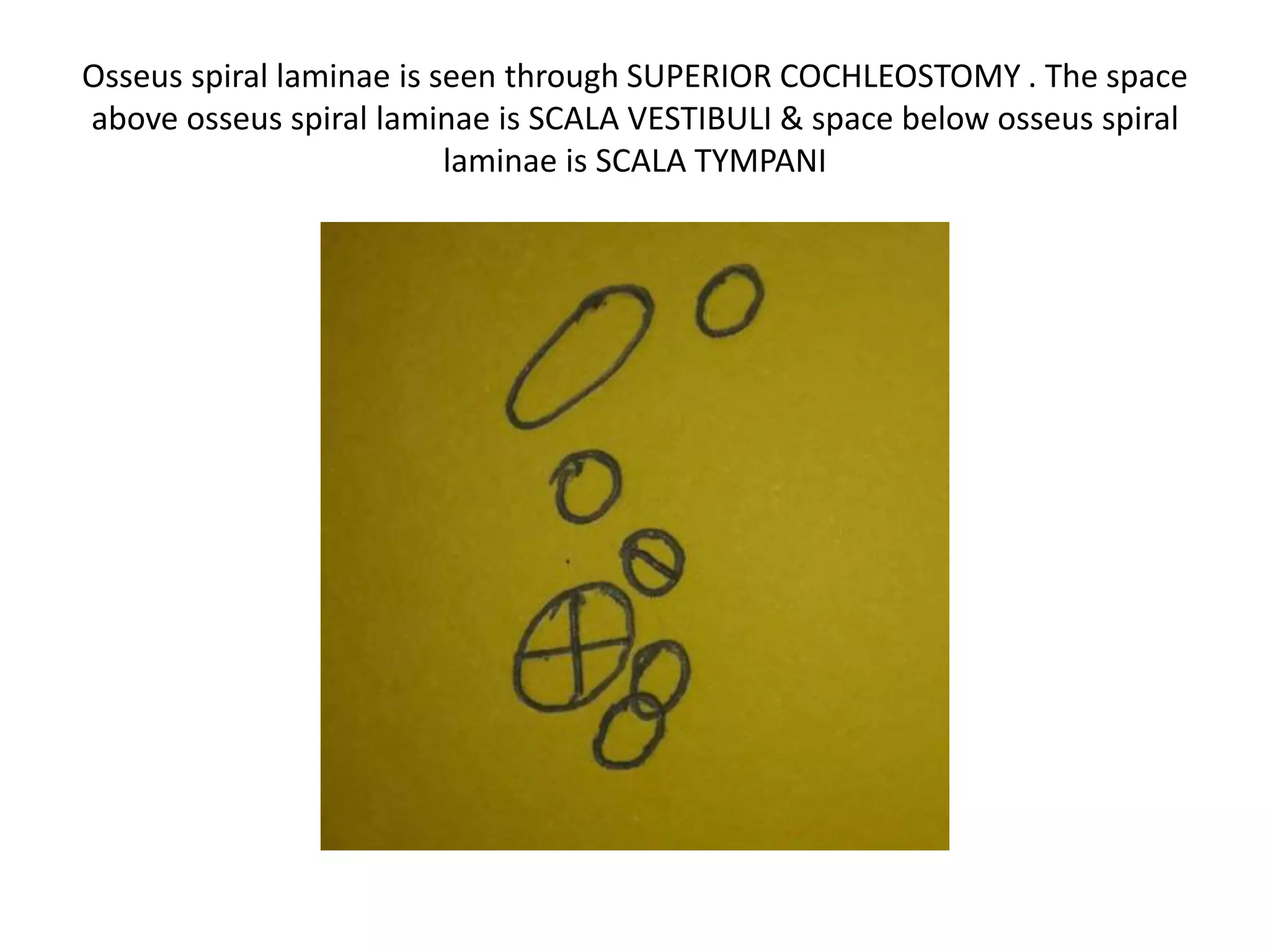 Cochlear implant - line diagrams | PPTX