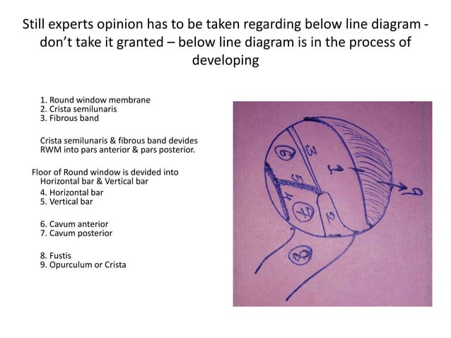 Cochlear implant - line diagrams | PPTX