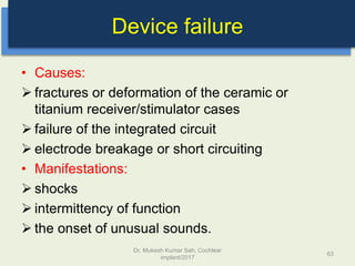 Cochlear implant mukace final | PPTX