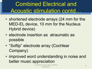 Cochlear implant mukace final | PPTX