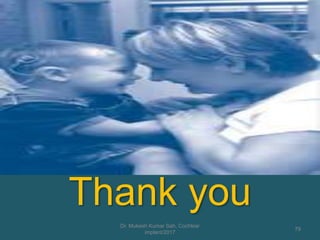 Cochlear implant mukace final | PPTX