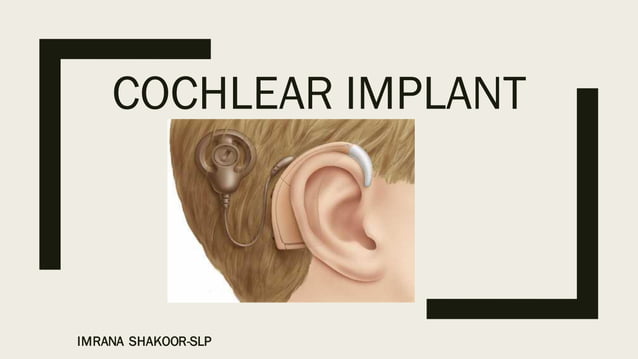 Cochlear Implant for deaf and hard of hearing | PDF | Digital Audio ...