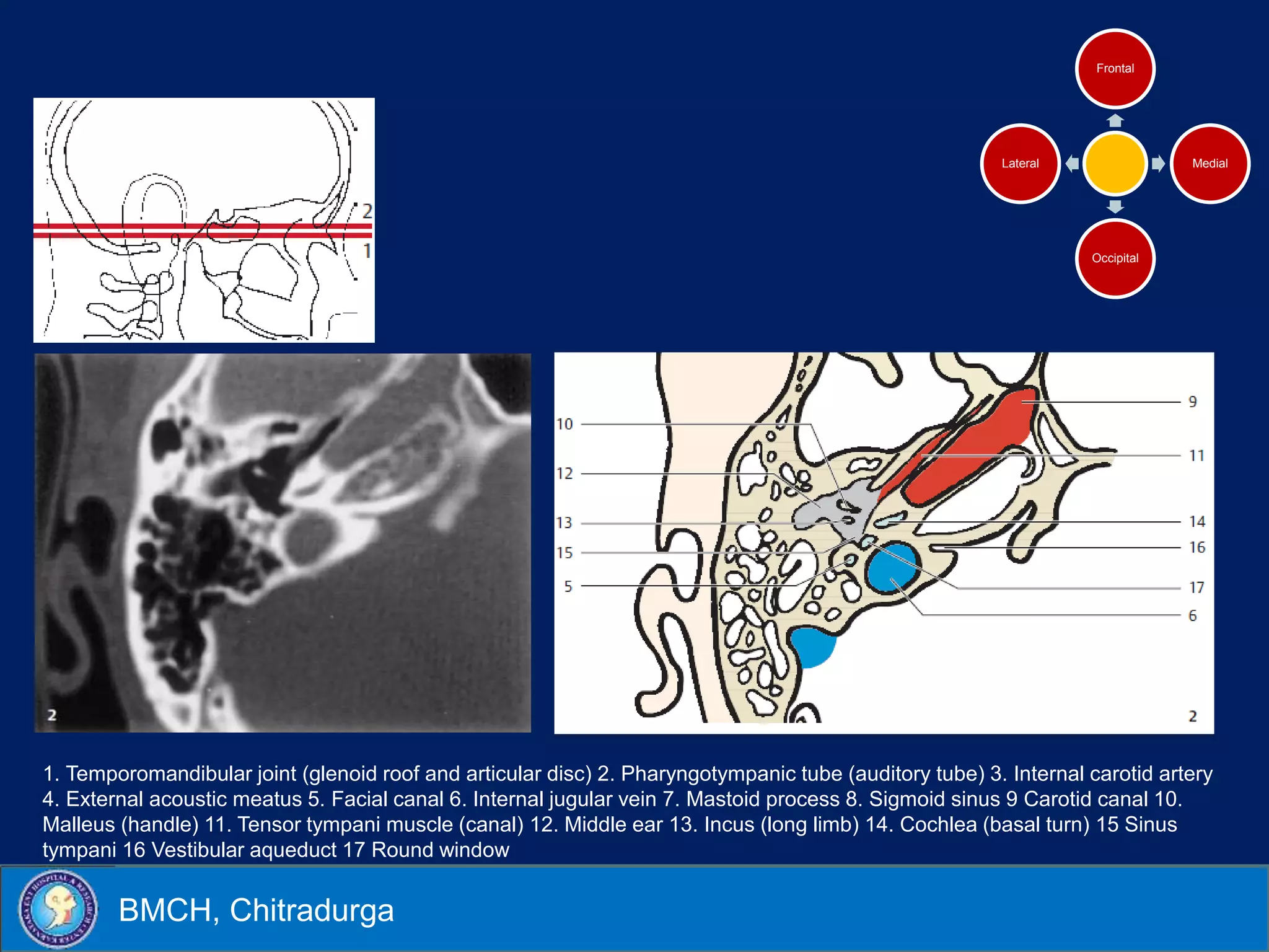 Cochlear implant imaging | PPSX
