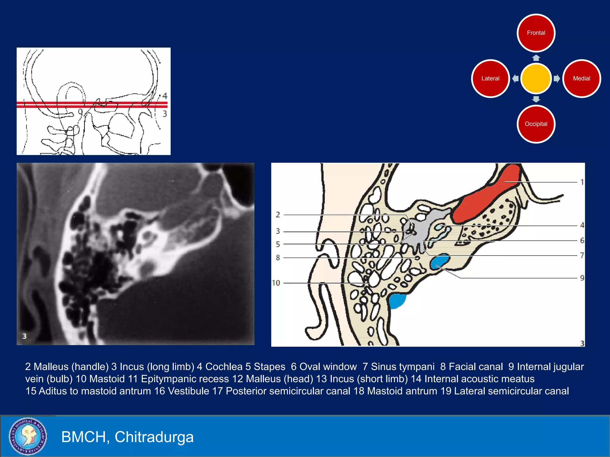 Cochlear implant imaging | PPSX