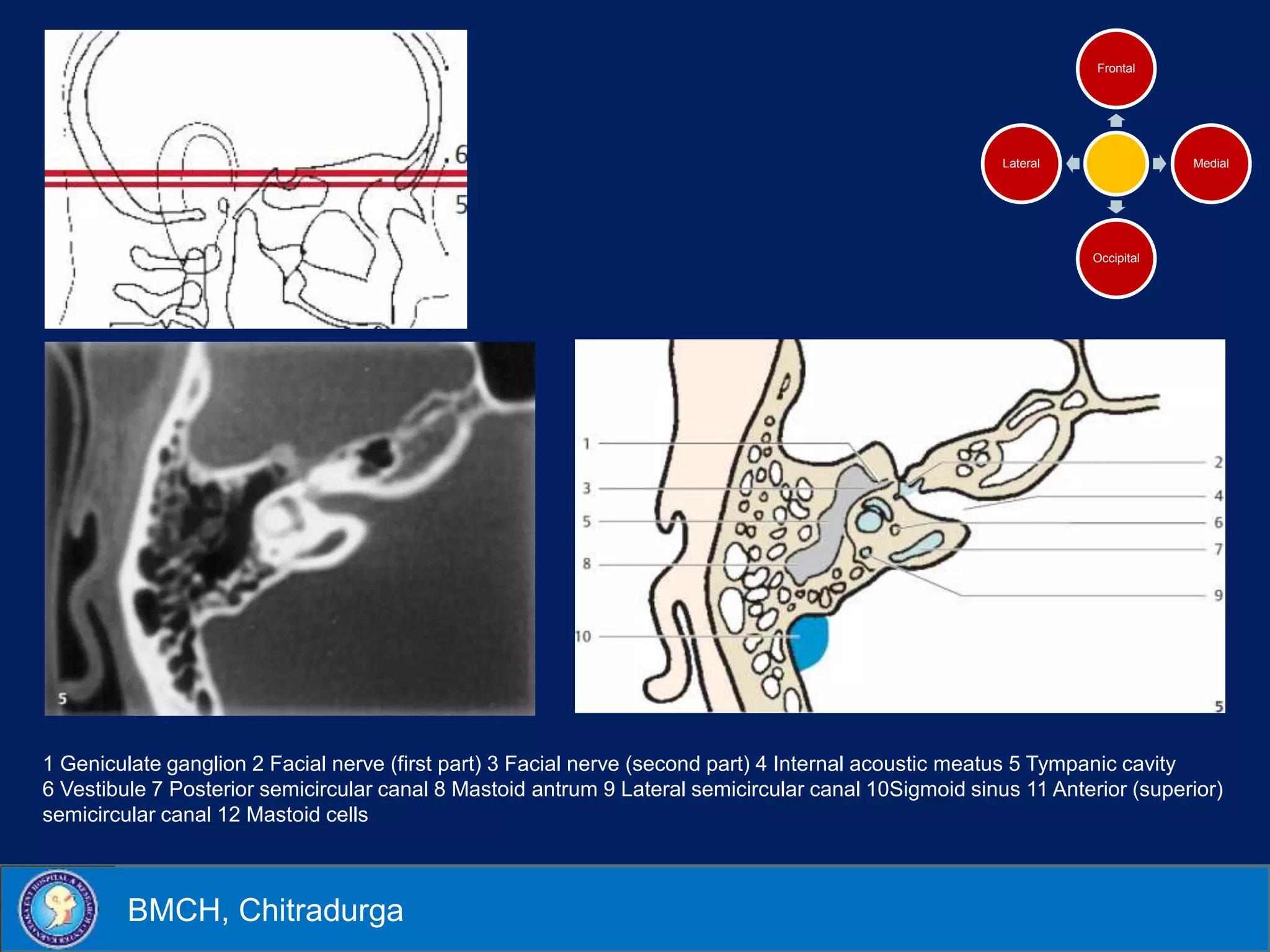Cochlear implant imaging | PPSX