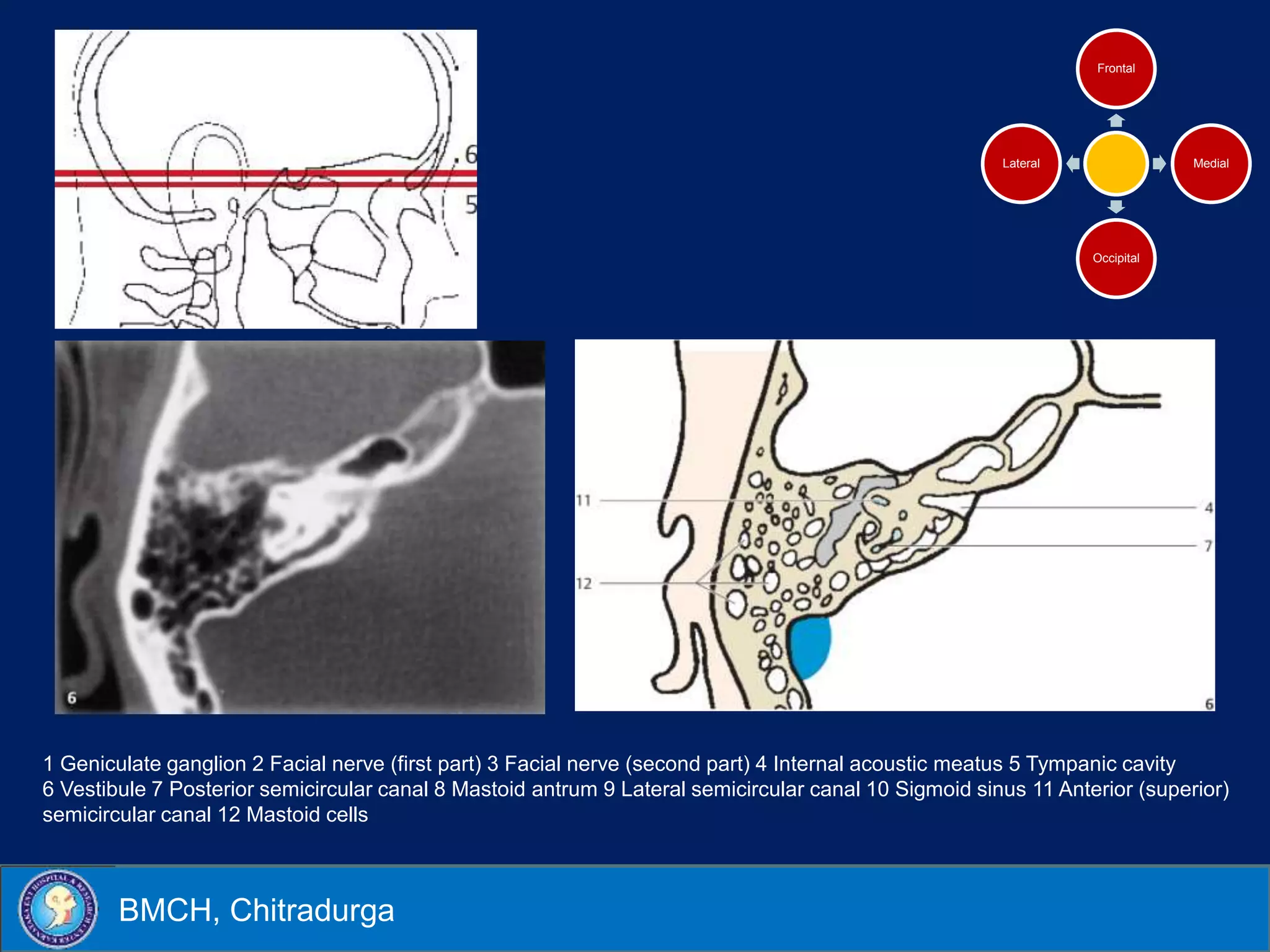 Cochlear implant imaging | PPSX
