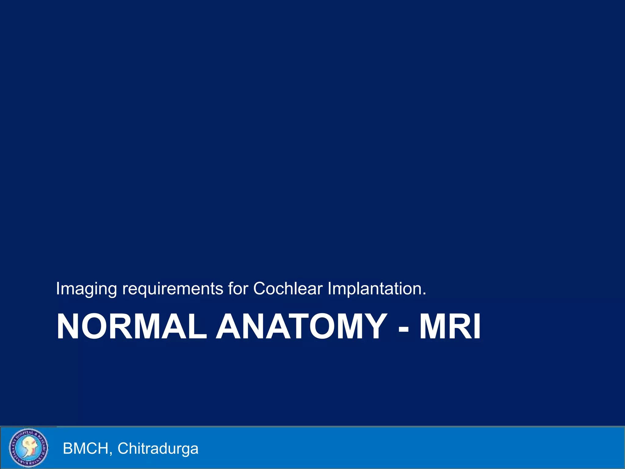 Cochlear implant imaging | PPSX