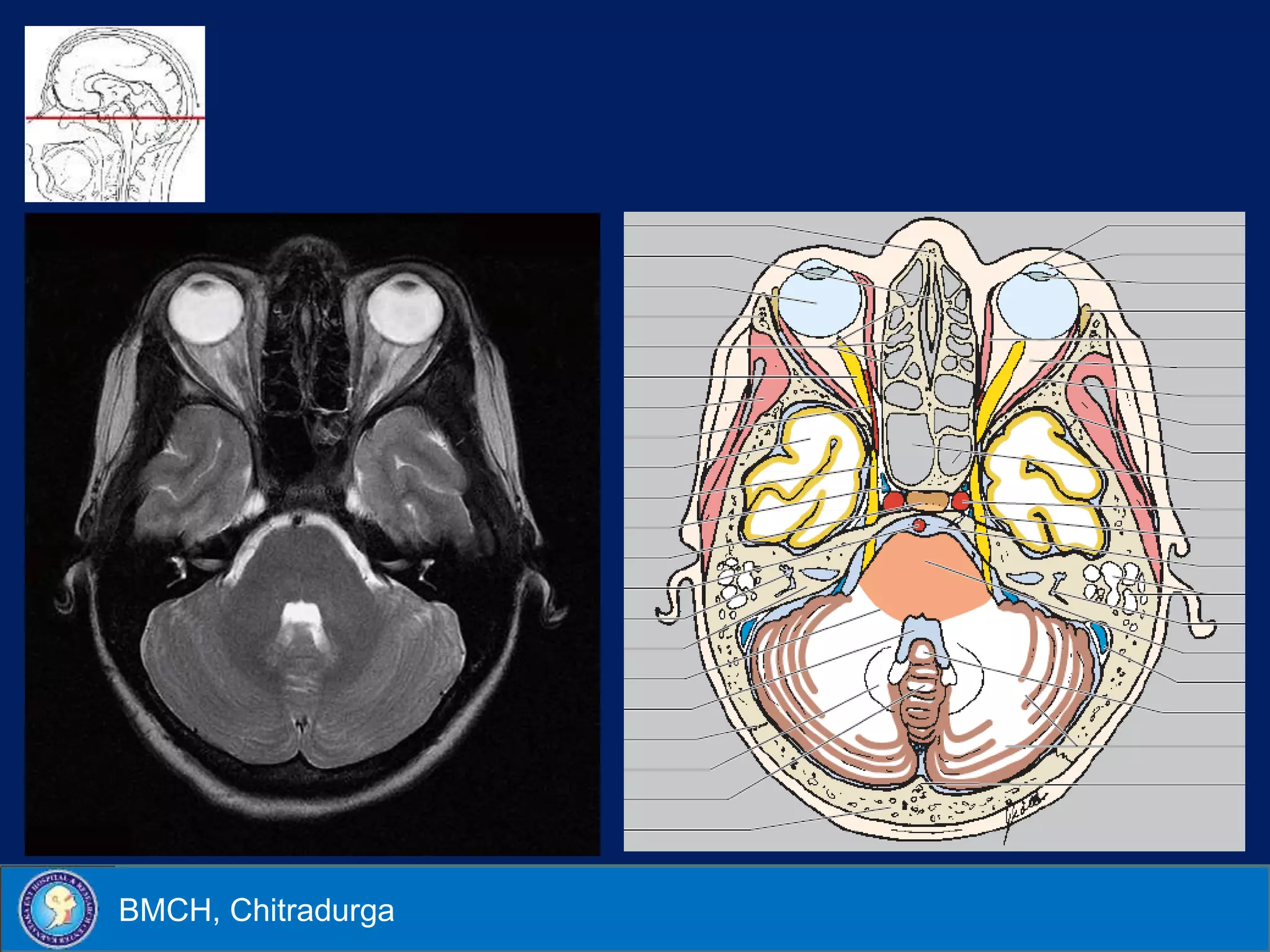 Cochlear implant imaging | PPSX