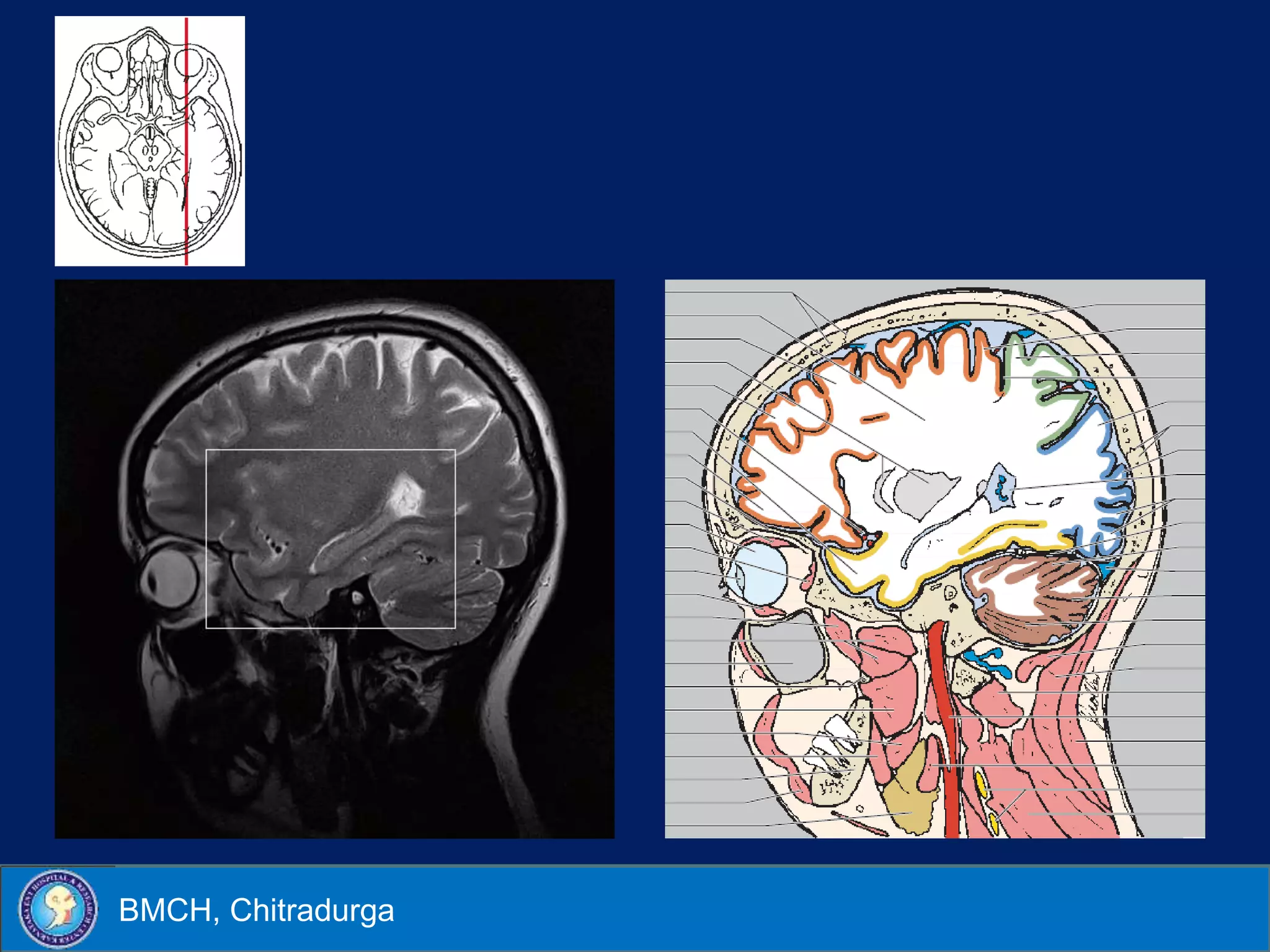 Cochlear implant imaging | PPSX
