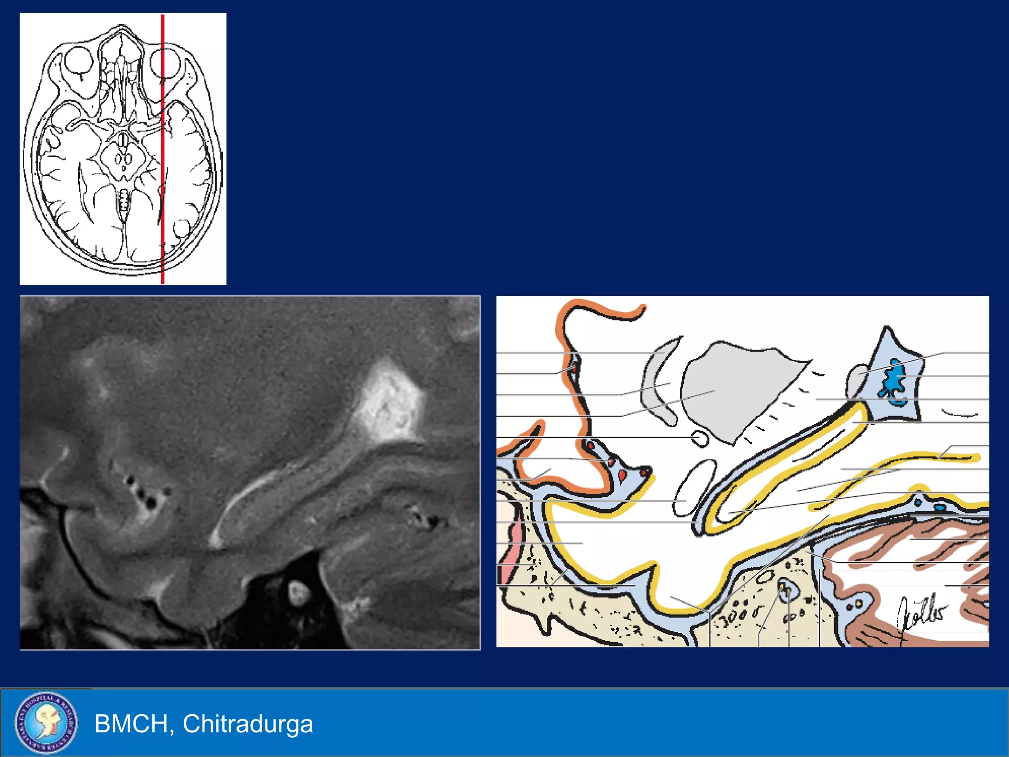 Cochlear implant imaging | PPSX