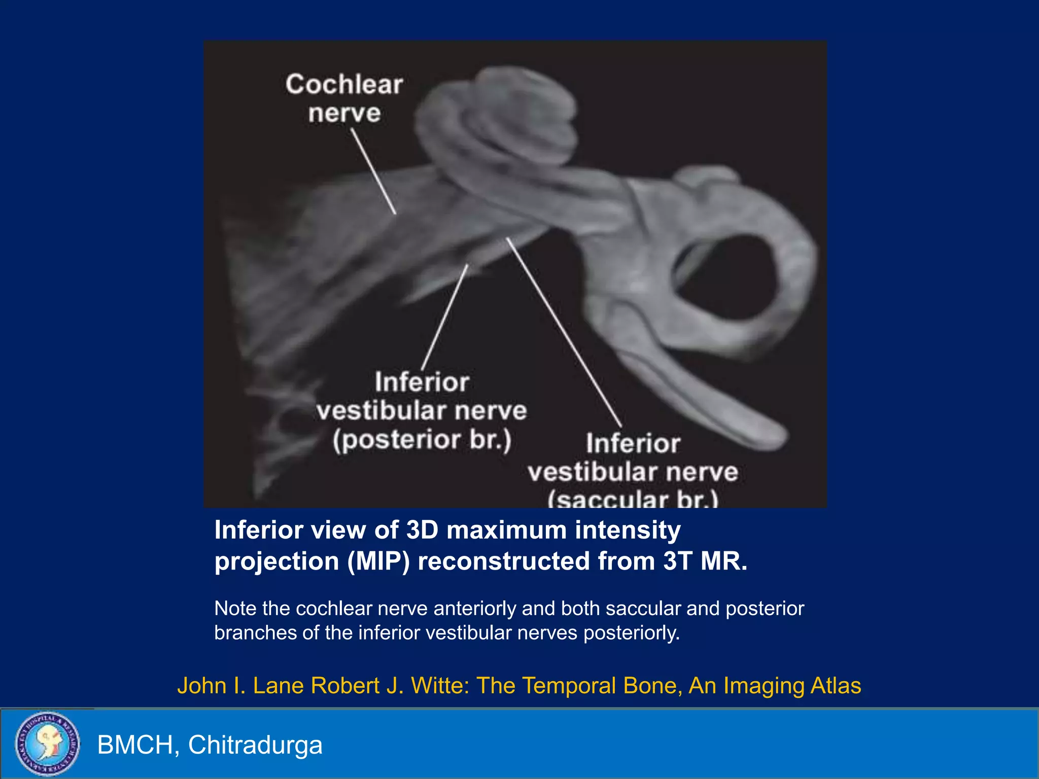 Cochlear implant imaging | PPSX