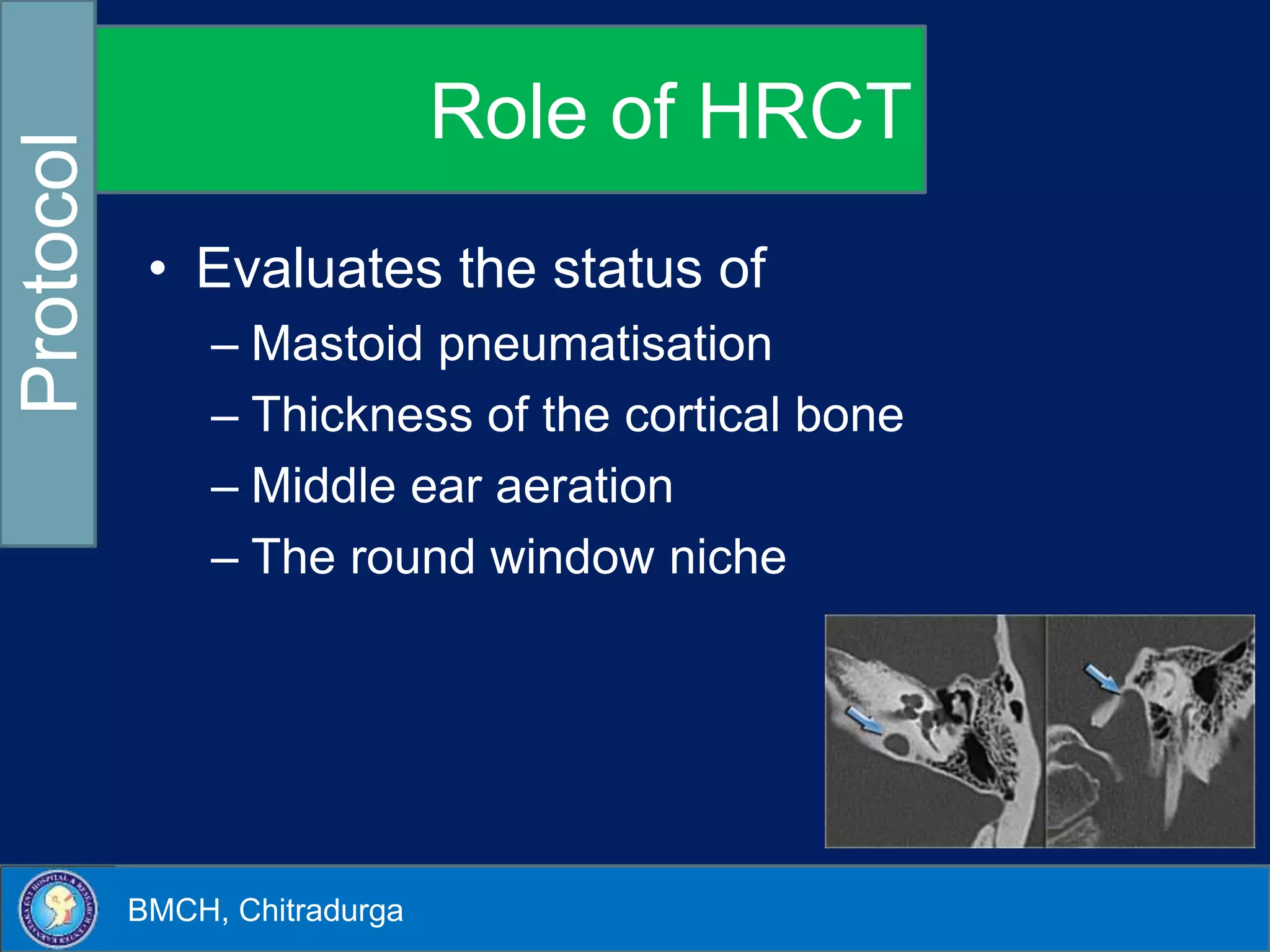 Cochlear implant imaging | PPSX