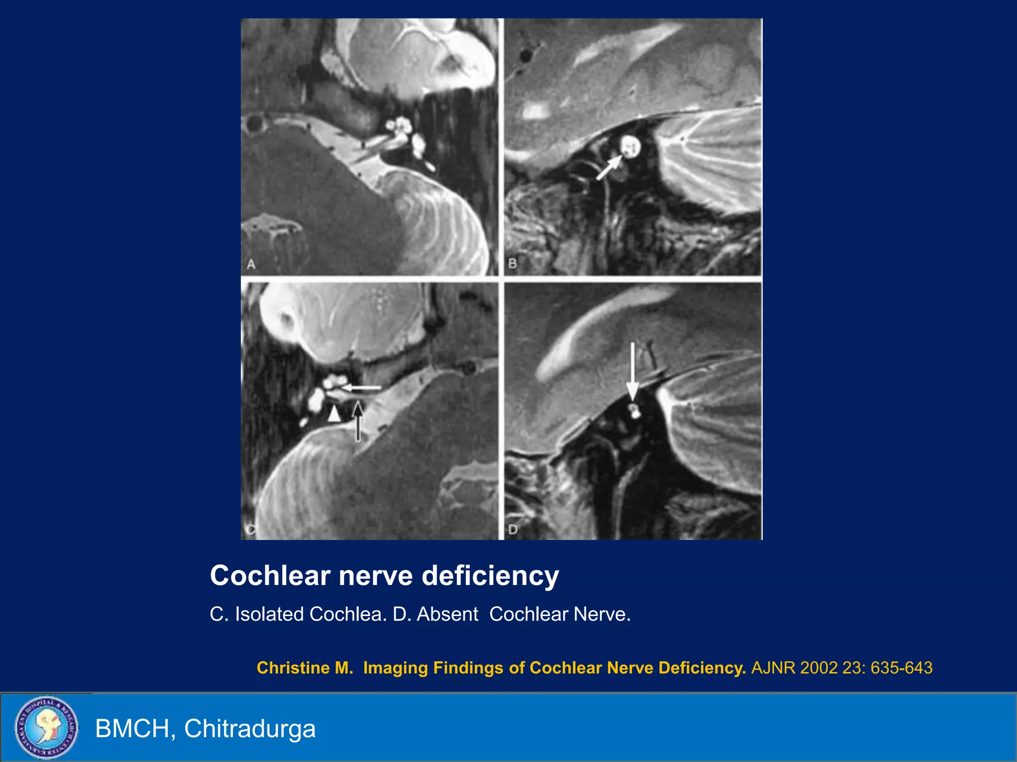 Cochlear implant imaging | PPSX