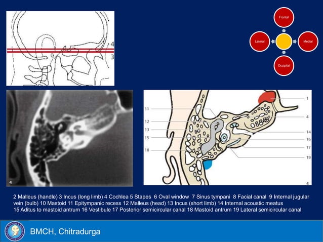 Cochlear implant imaging | PPSX