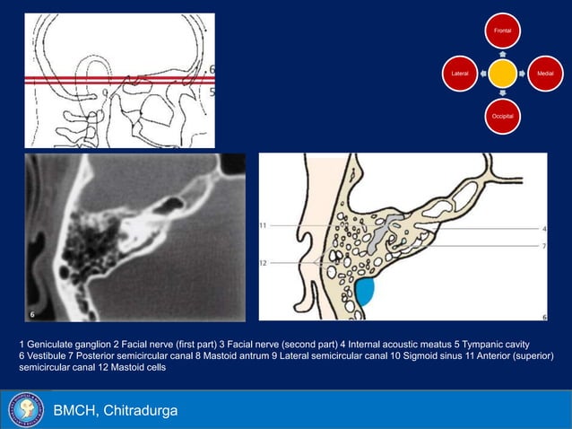 Cochlear implant imaging | PPSX