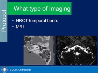 Cochlear implant imaging | PPT