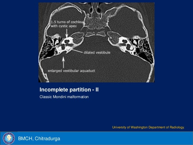 Cochlear implant imaging
