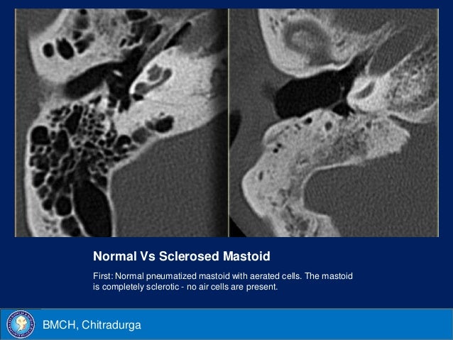 Cochlear implant imaging