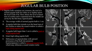 Cochlear implant imaging, radiological features | PPTX