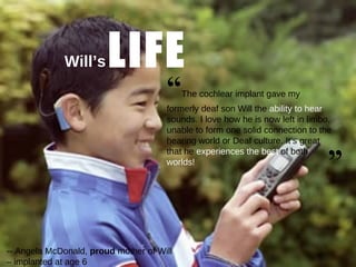 Cochlear Implants | PPT