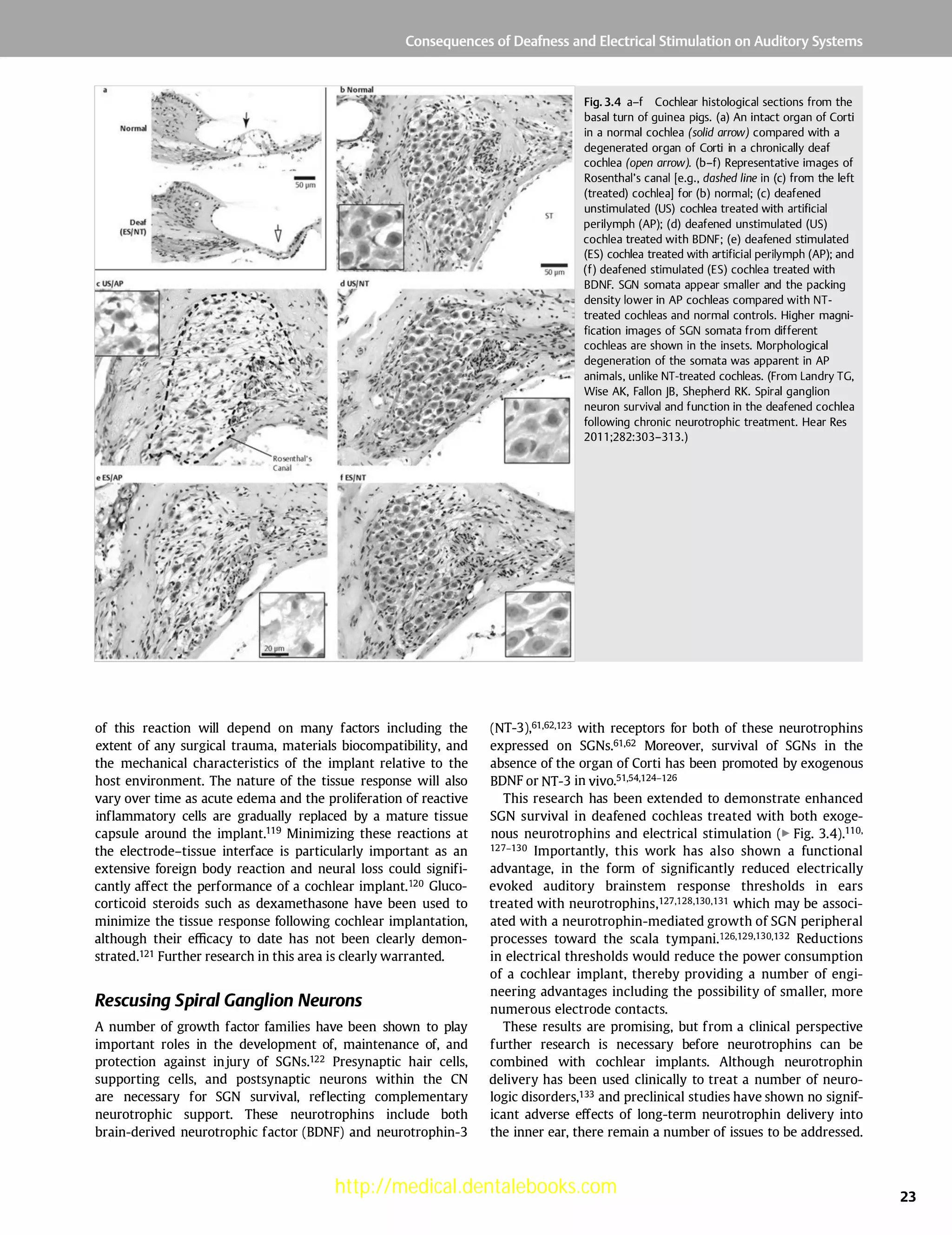 Cochlear implants: Indications, Investigation , Surgery | PDF