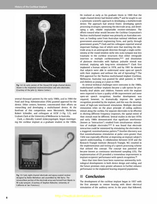 Cochlear implants: Indications, Investigation , Surgery | PDF