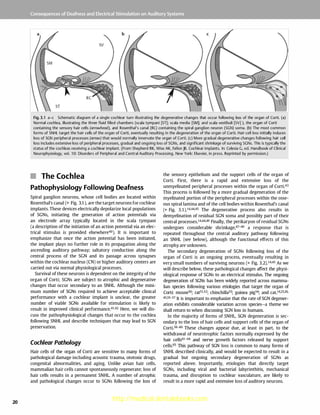 Cochlear implants: Indications, Investigation , Surgery | PDF