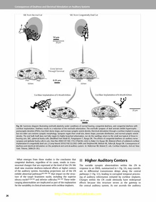 Cochlear implants: Indications, Investigation , Surgery | PDF