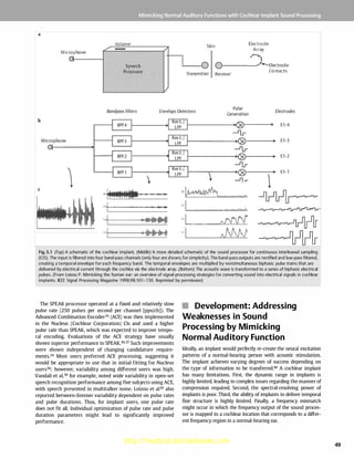 Cochlear implants: Indications, Investigation , Surgery | PDF