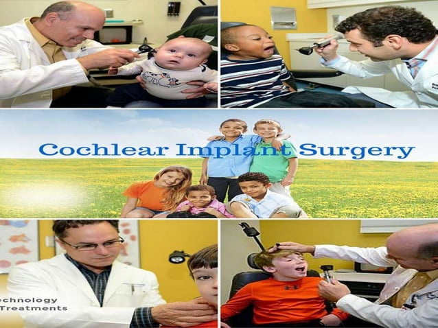 Cochlear implant surgery | PPTX | Ear, Nose and Throat Conditions ...