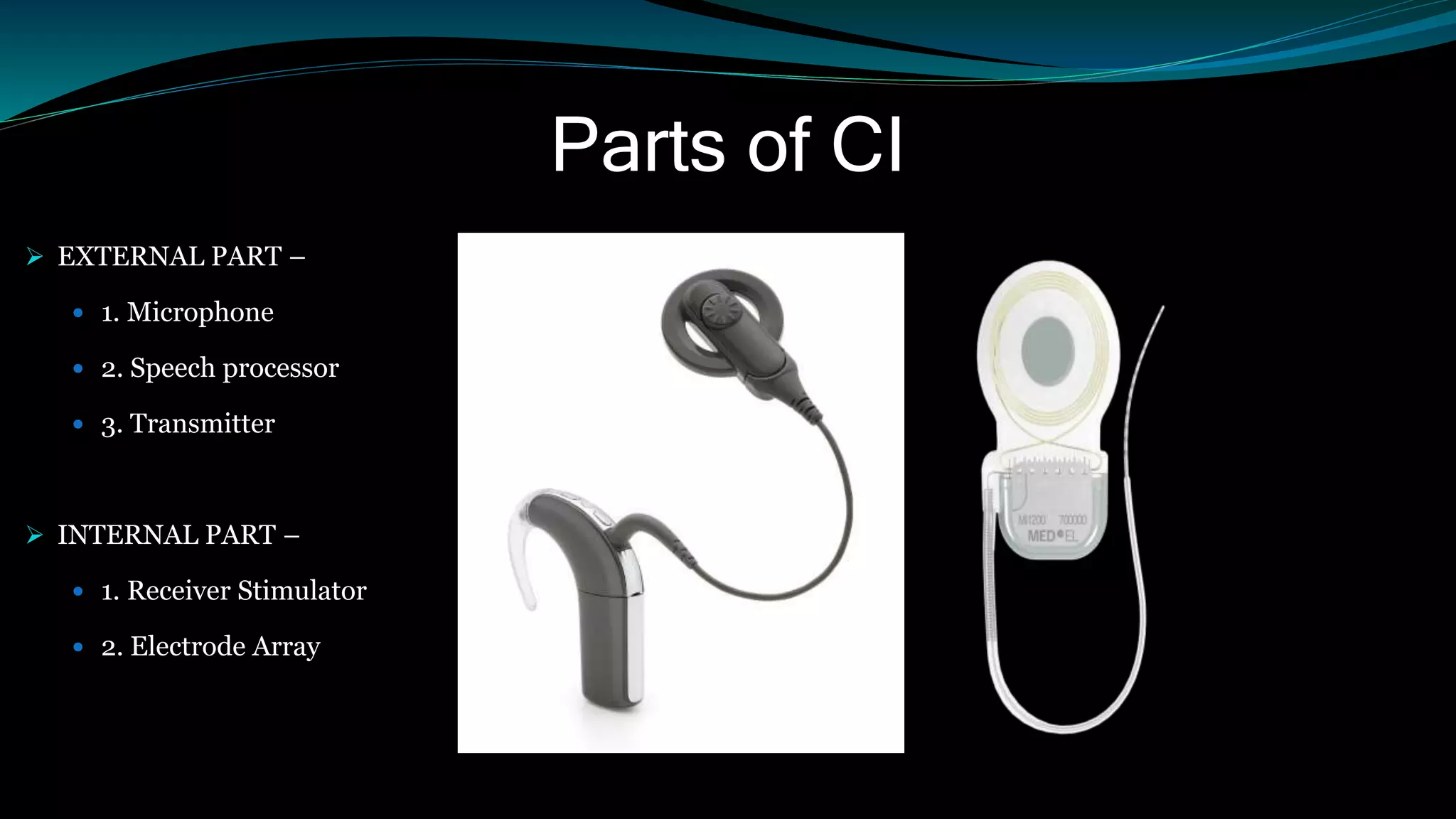 Cochlear implant surgery | PPTX