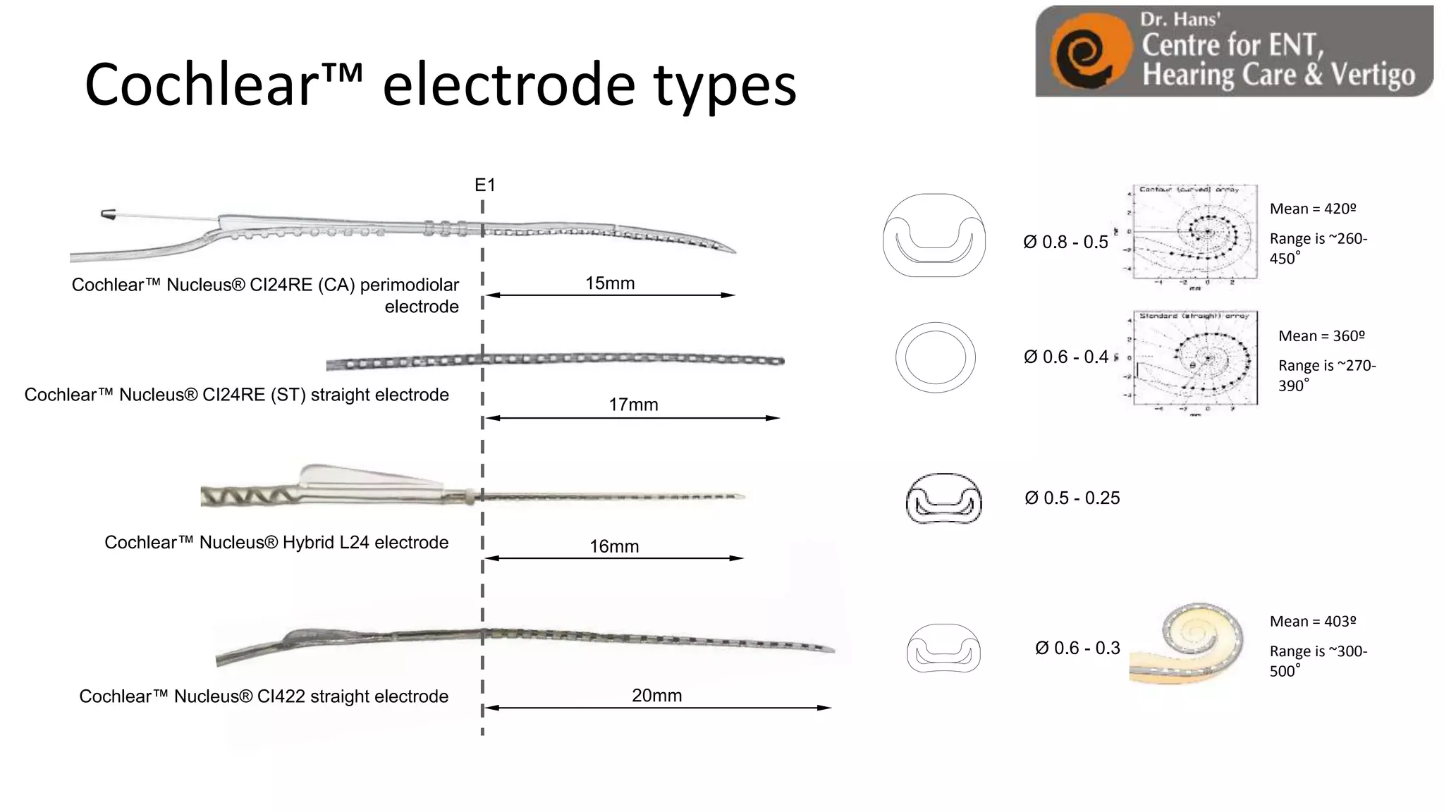 Cochlear implant systems | PPTX